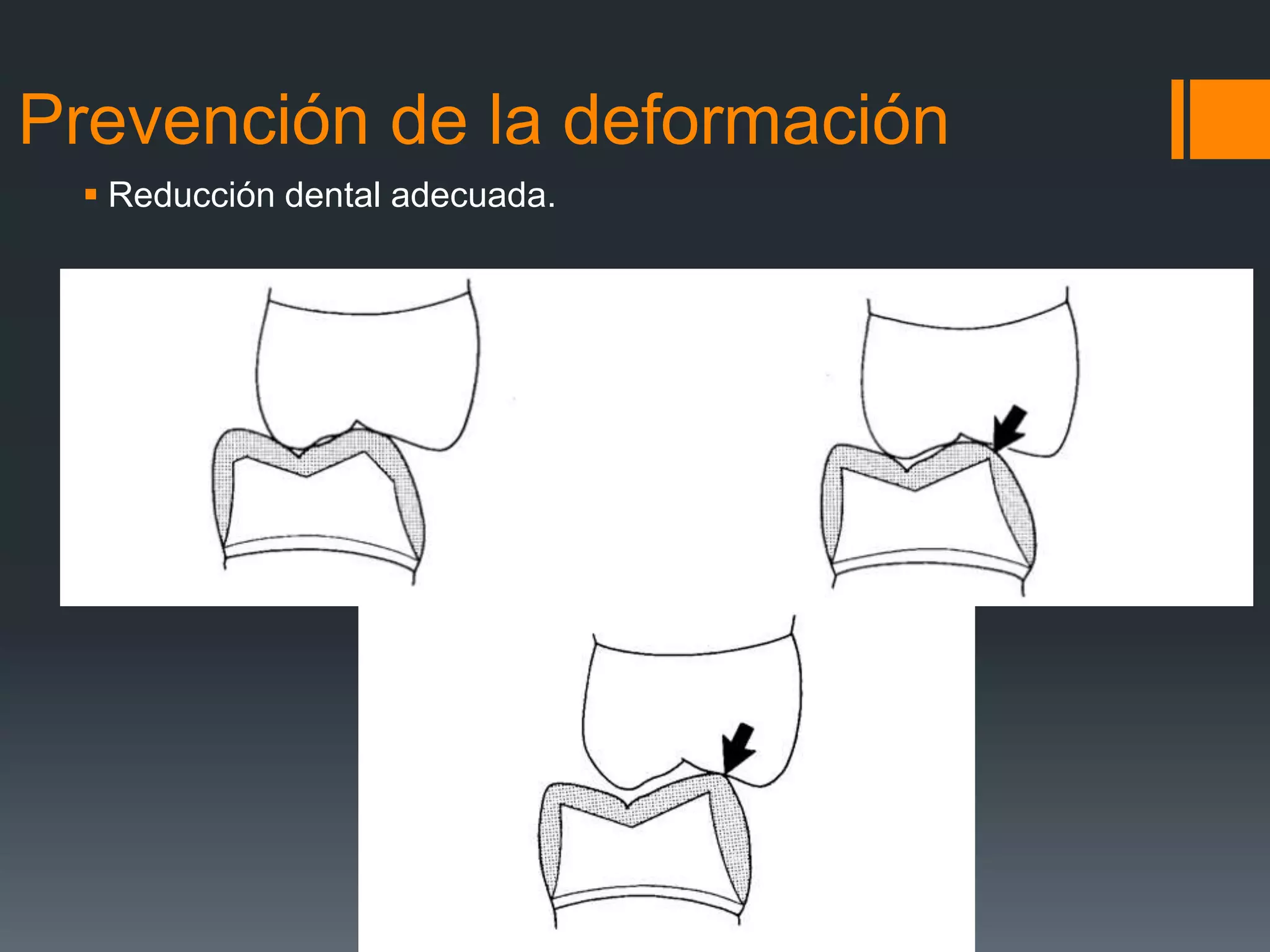 Principios para el tallado de dientes en prótesis | PPTX | Oral care ...