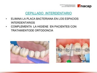 Clase 5 tratamiento periodontal higienene bucal | PPTX
