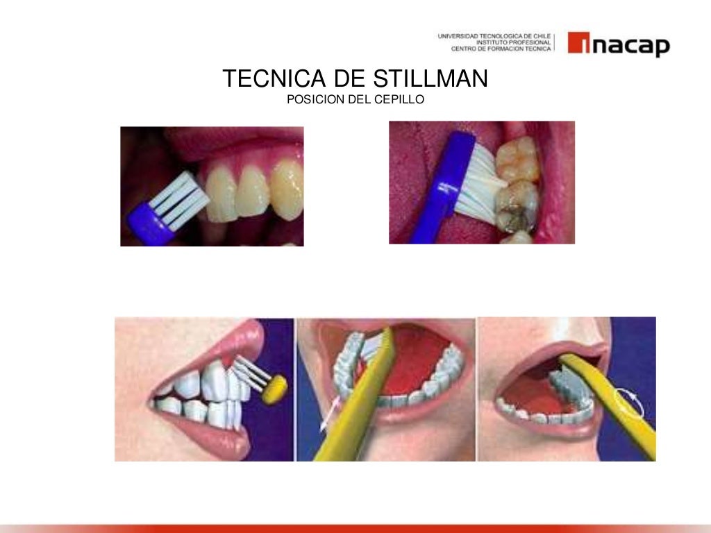 Clase 5 tratamiento periodontal higienene bucal