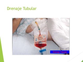 ClaseDrenajes.pptx