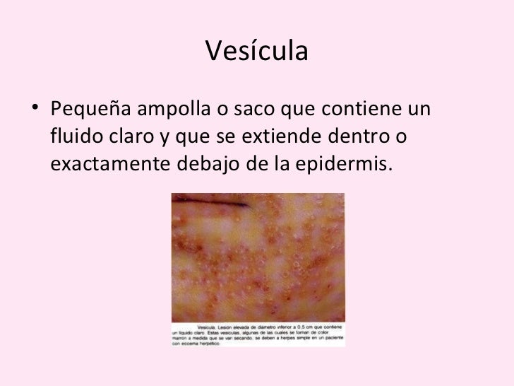 Clase #7 lesiones de la piel