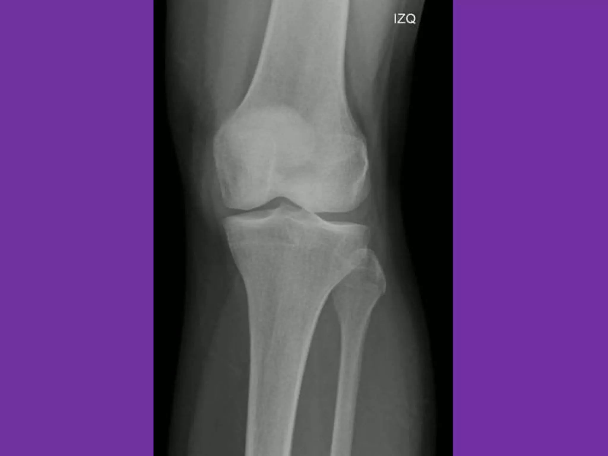 Clase 7 - Muslo y Rodilla | PPTX