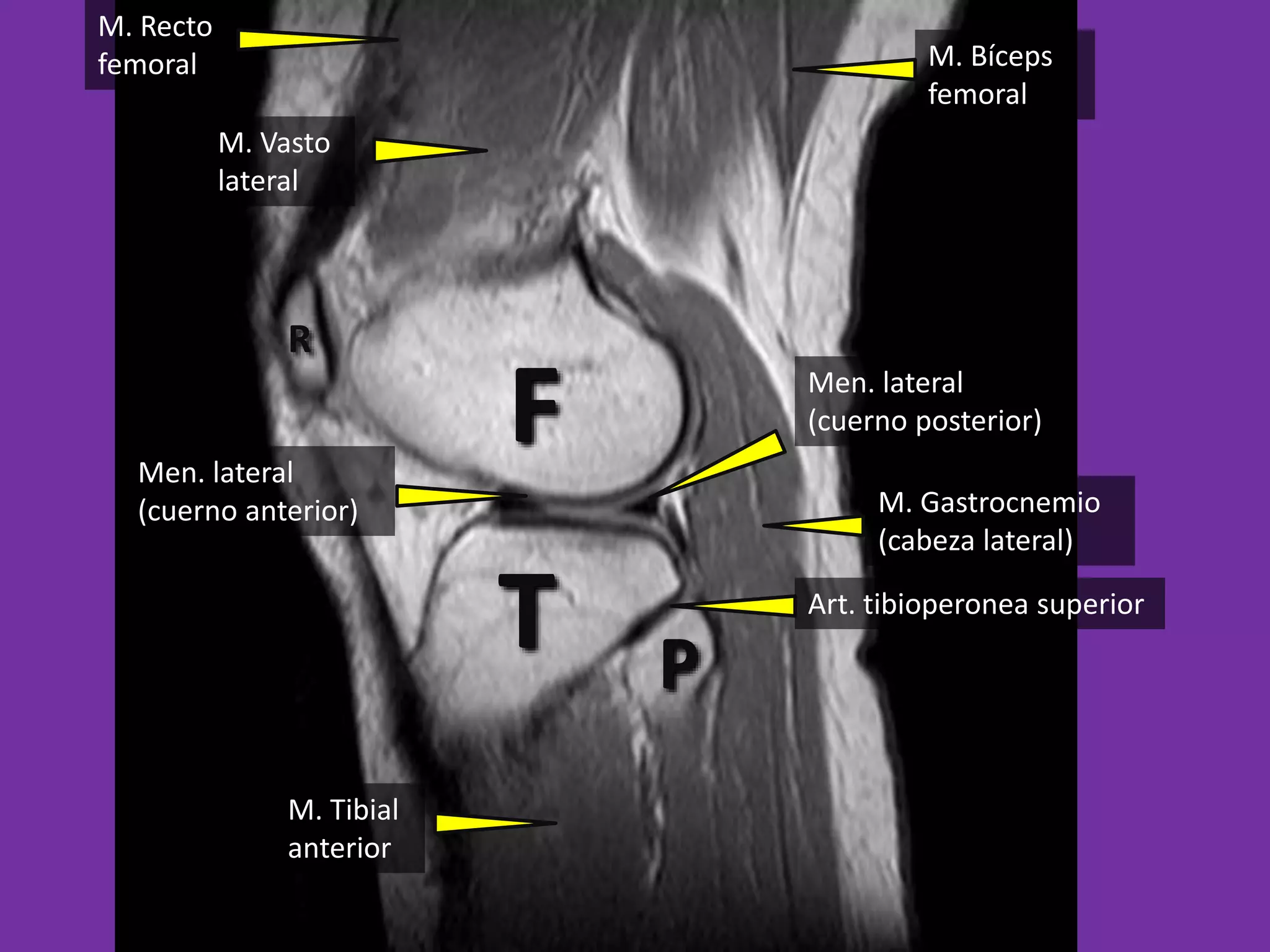 Clase 7 - Muslo y Rodilla | PPTX