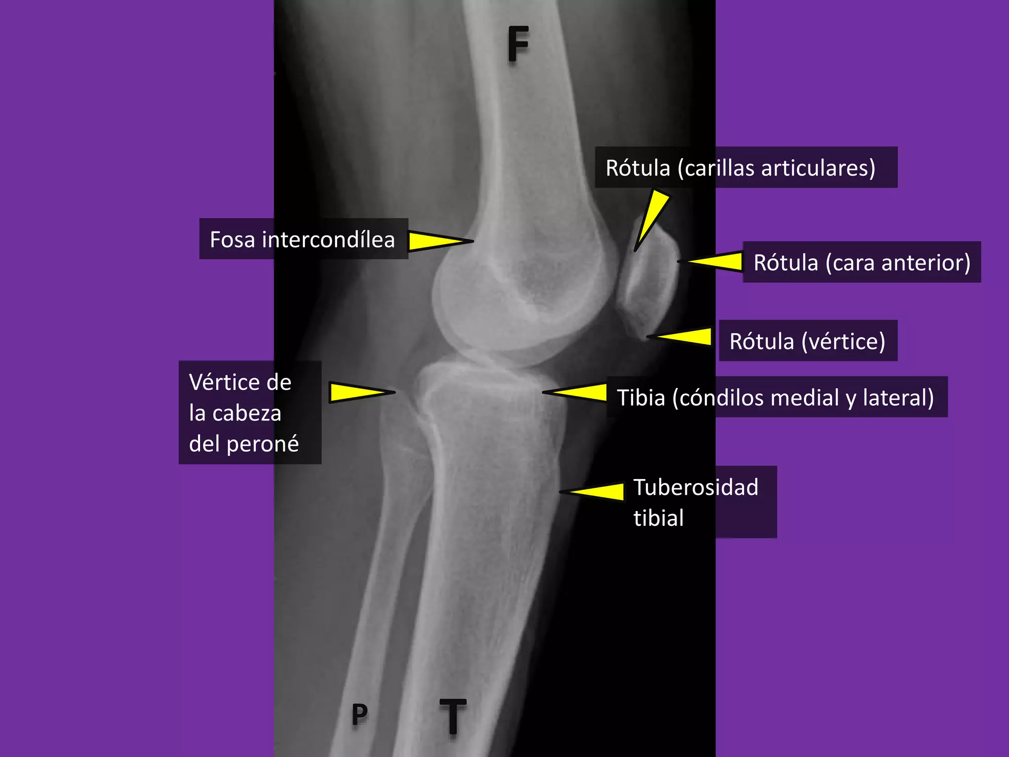 Clase 7 - Muslo y Rodilla | PPTX