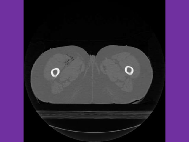 Clase 7 - Muslo y Rodilla | PPTX