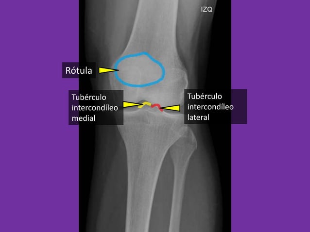 Clase 7 - Muslo y Rodilla | PPTX