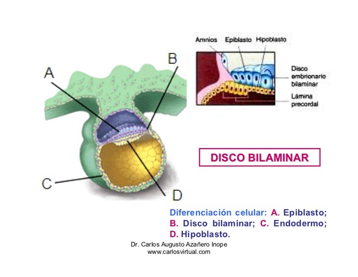 Disco Bilaminar Trilaminar