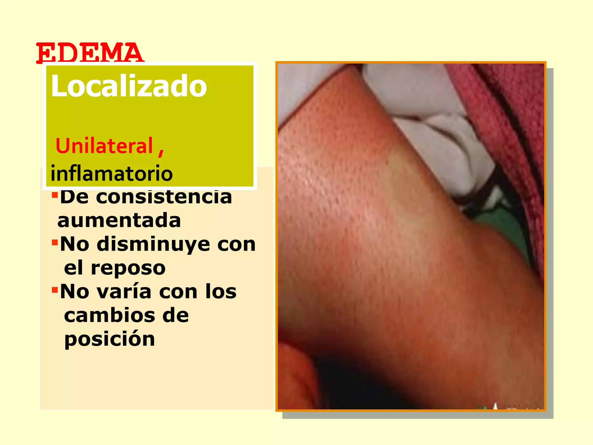 Clase 9 b edema | PPT