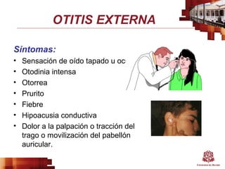 Síntomas De Otomicosis