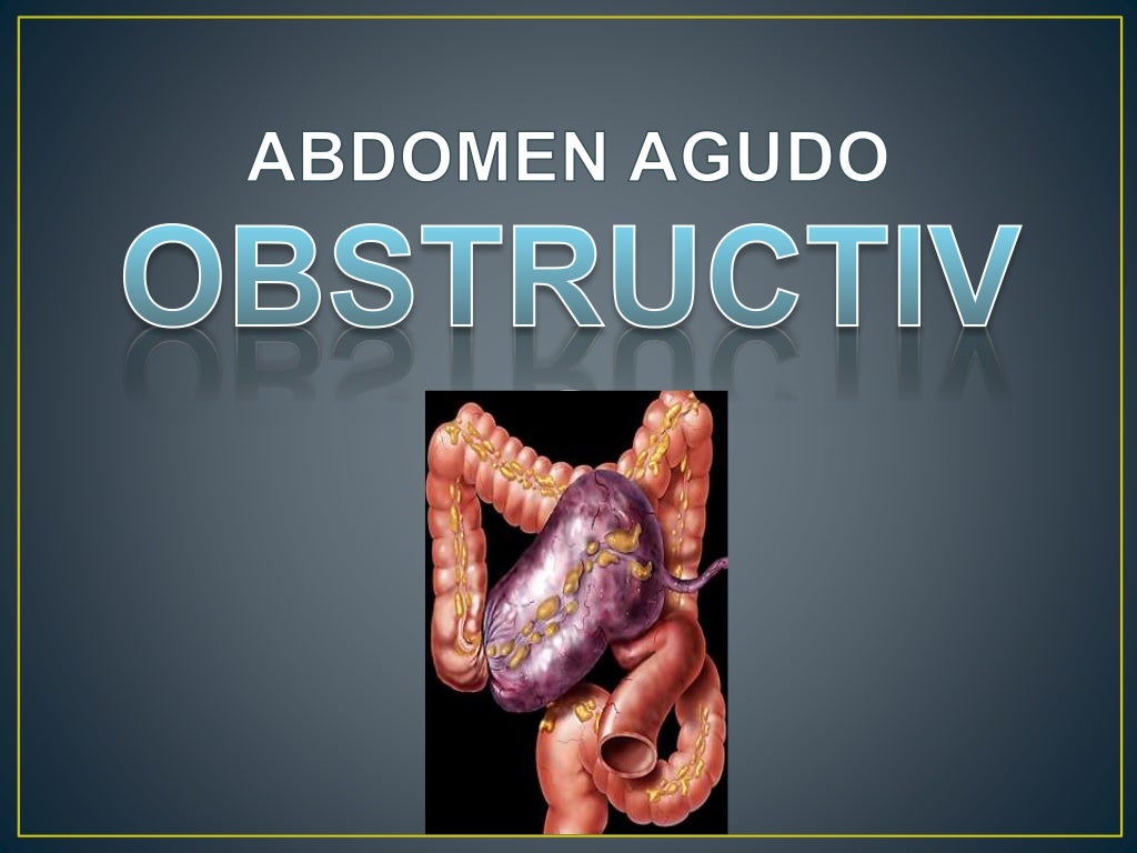 Cid 10 Abdome Agudo Obstrutivo - RETOEDU