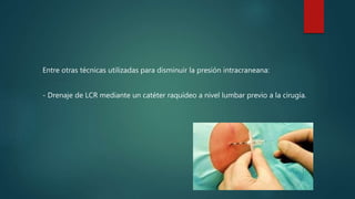 Clase anestesia para cirugia vascular | PPTX