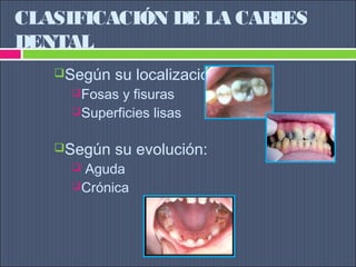 Epidemiología de la caries dental | PPT