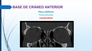 CIRUGIA ENDOSCOPICA DE NARIZ Y SENOS PARANASALES | PPTX