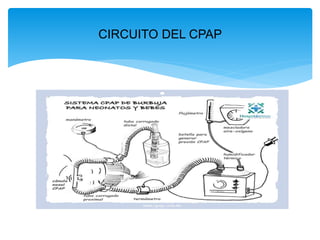 Clase cpap ucin. | PPTX
