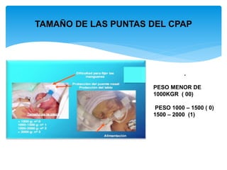 Clase cpap ucin. | PPTX