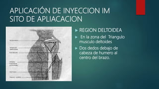 Clase de aplicacion de inyeccion im | PPTX