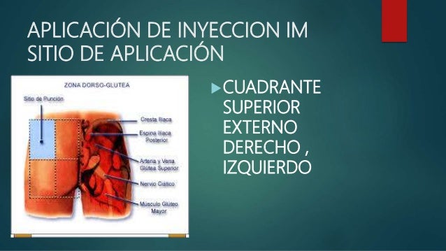 Clase de aplicacion de inyeccion im