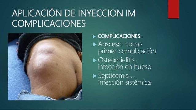 Clase de aplicacion de inyeccion im