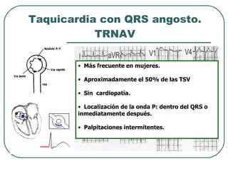 Clase de arritmias cardiacas medicos rte graduación | PPT
