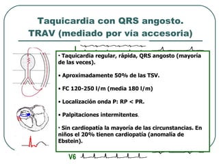 Clase de arritmias cardiacas medicos rte graduación | PPT
