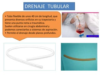 CLASE DE DRENAJES LHYD.pptx