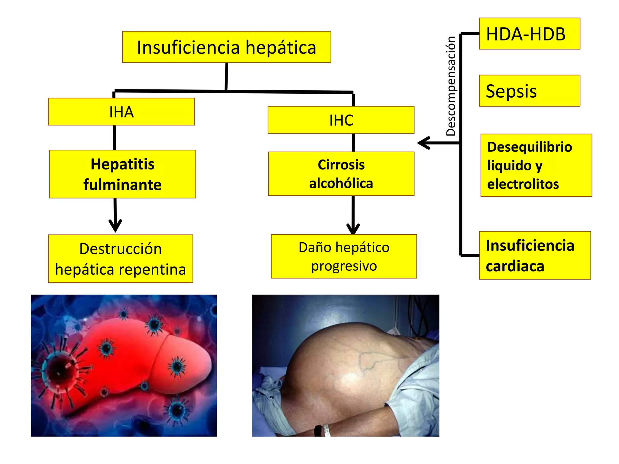 insuficiencia hepatica by Md Jimena Aguilar Escobar | PPT