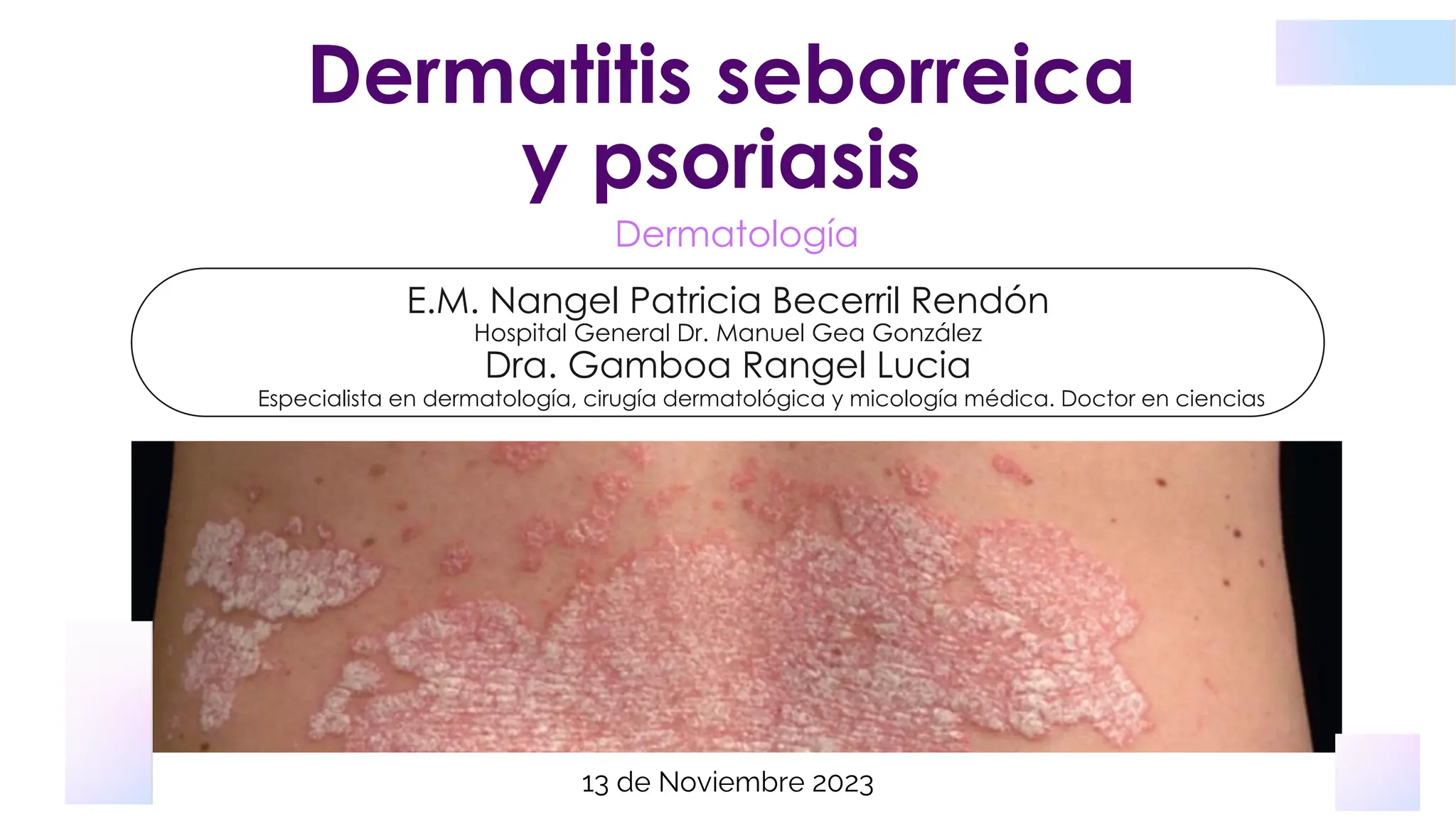 Clase Dermatitis seborreica y Psoriasis.pdf