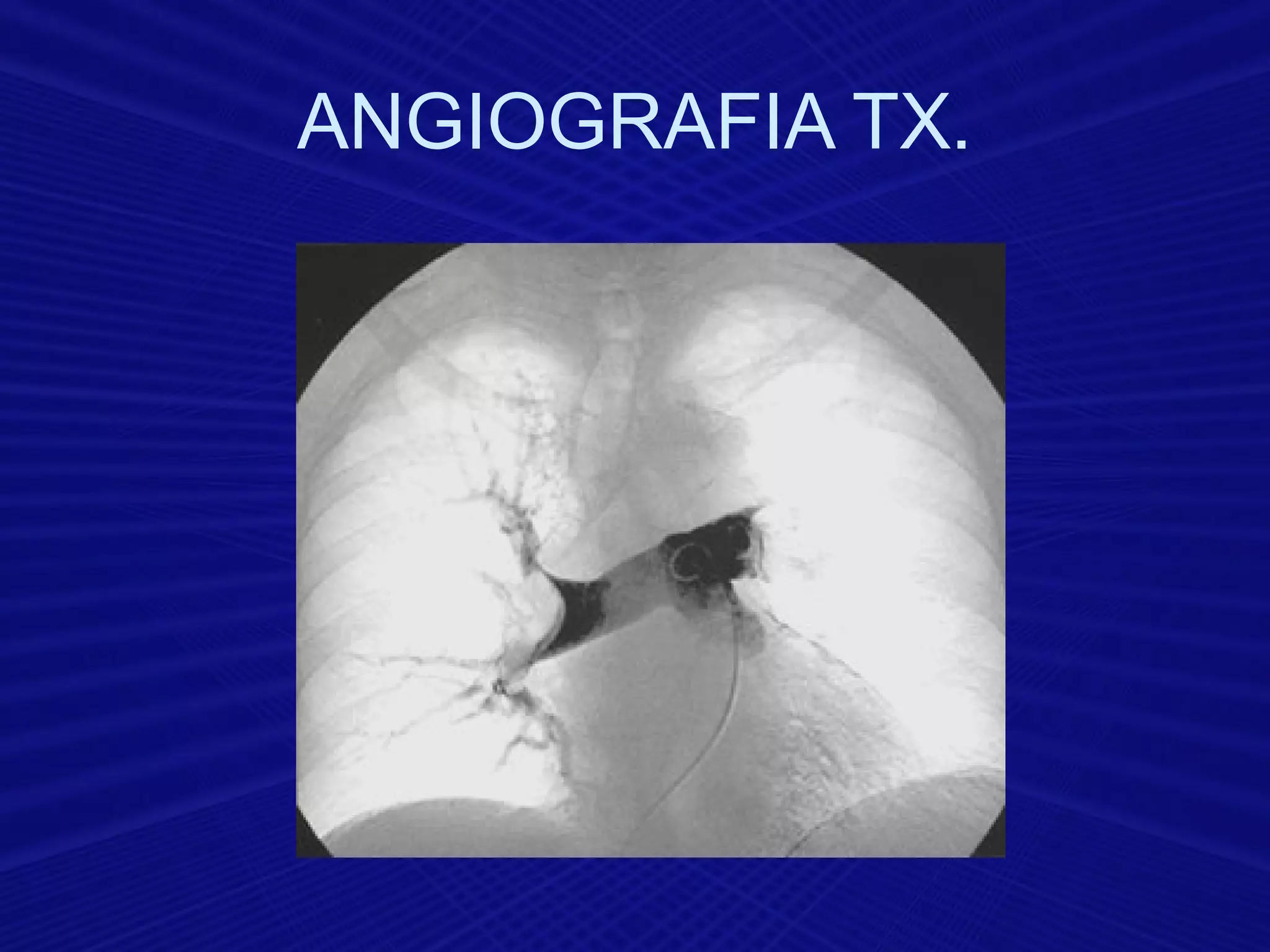 Clase de torax | PPT