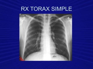 Clase de torax | PPT