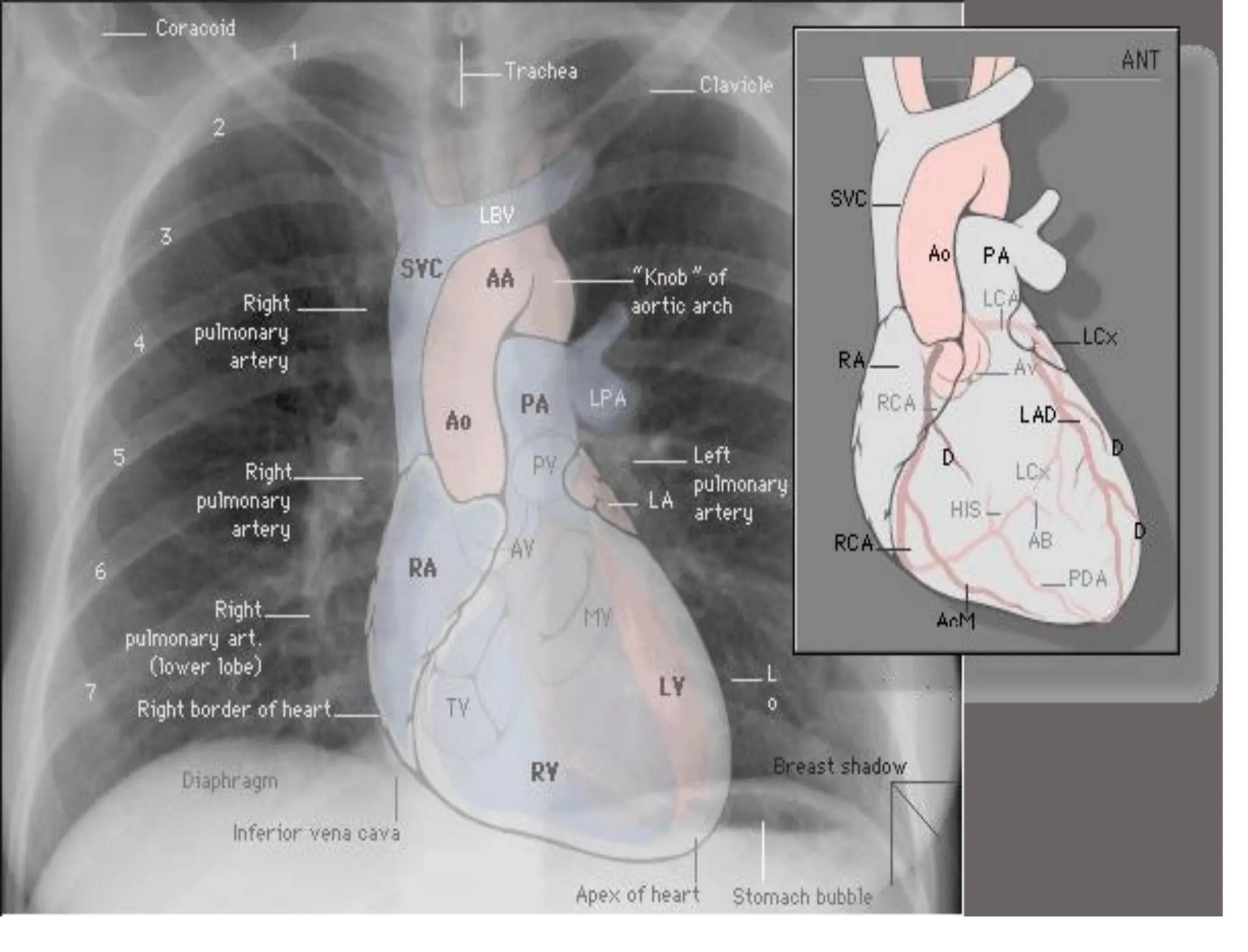 Parametros y patología de Tórax. En radiologia | PPT