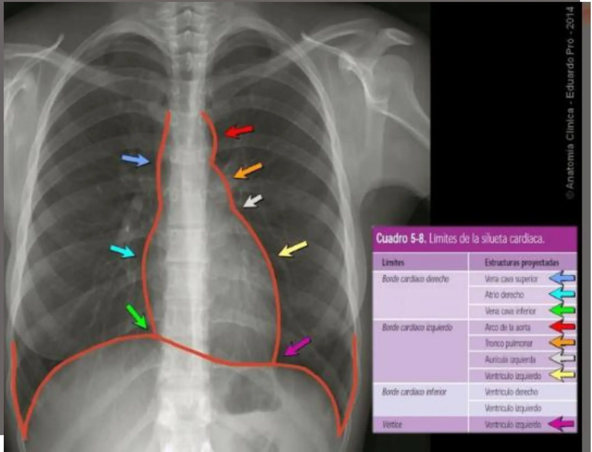 Parametros y patología de Tórax. En radiologia | PPT