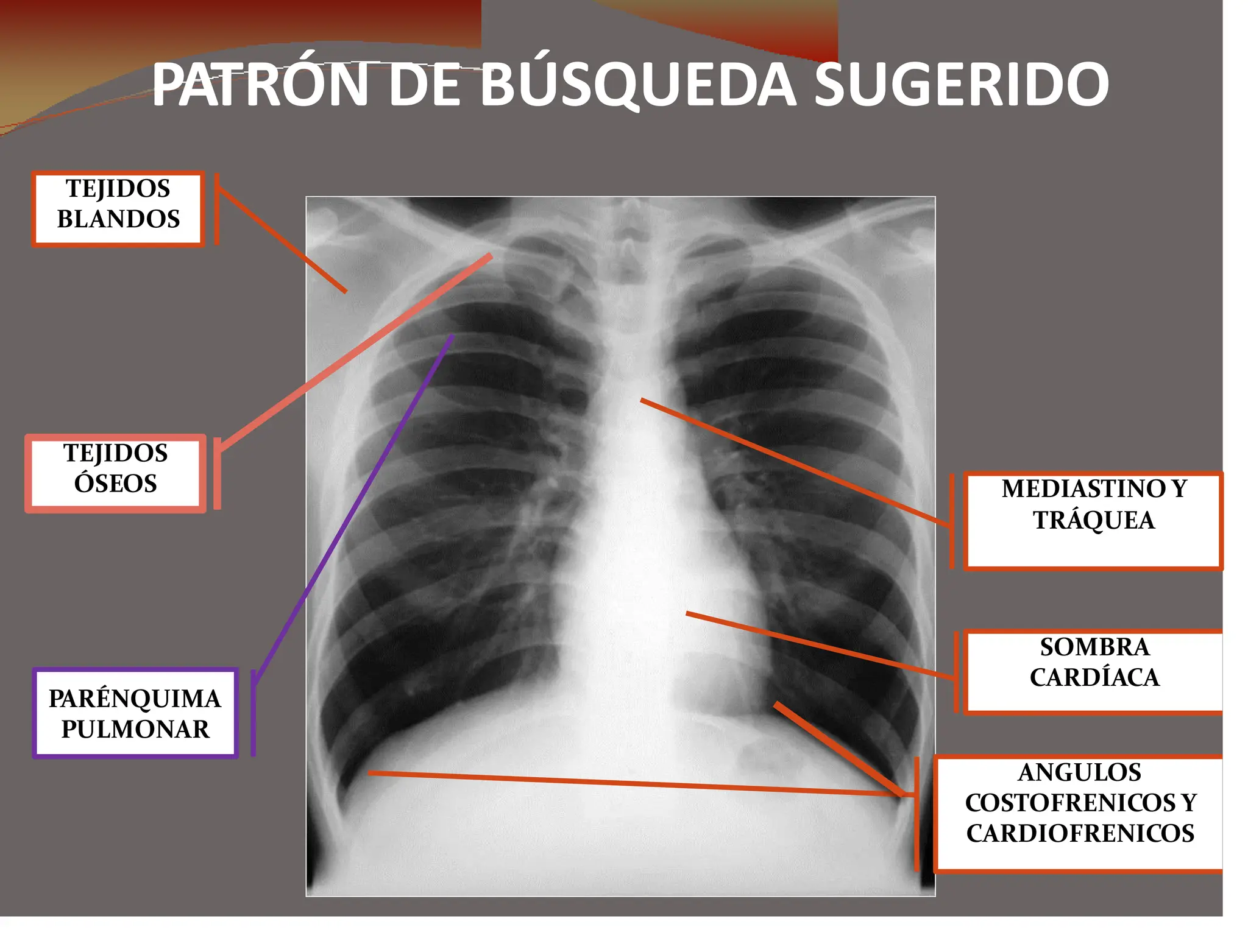 Parametros y patología de Tórax. En radiologia | PPT