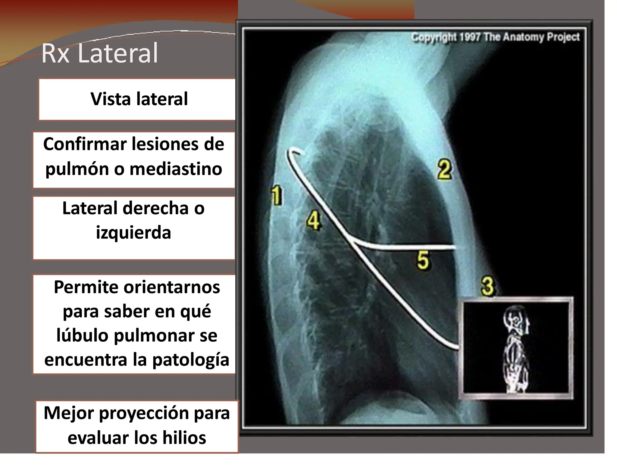 Parametros y patología de Tórax. En radiologia | PPT