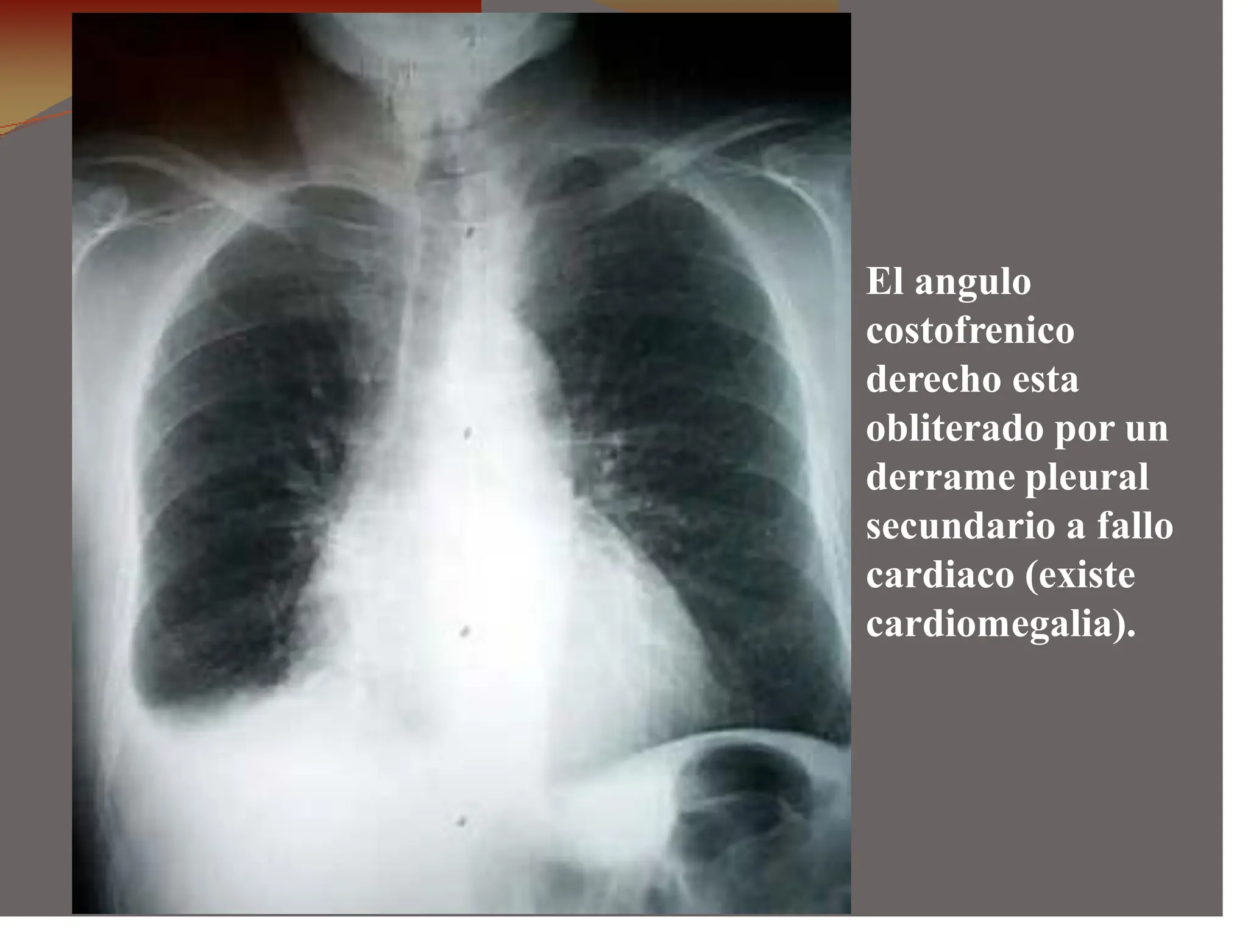 Parametros y patología de Tórax. En radiologia | PPT