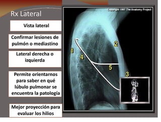 Parametros y patología de Tórax. En radiologia | PDF