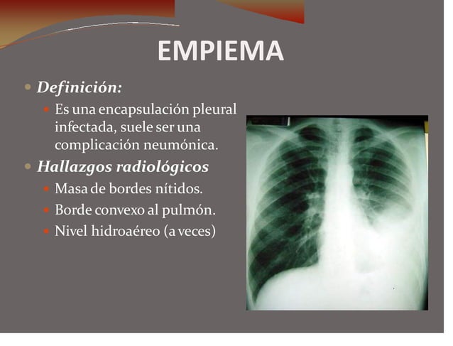 Parametros y patología de Tórax. En radiologia | PPT