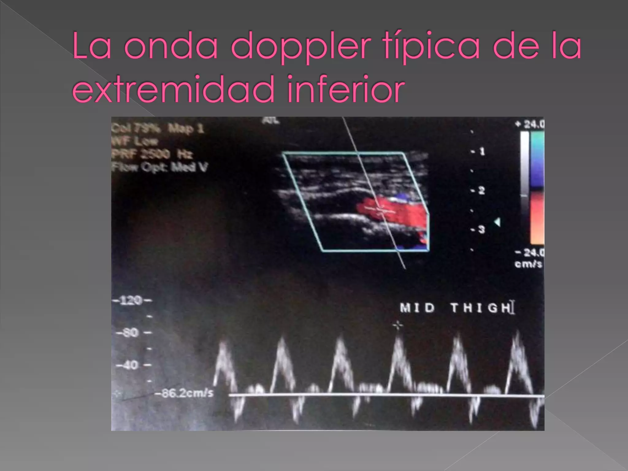Clase doppler arterial de miembros inferiores | PPTX