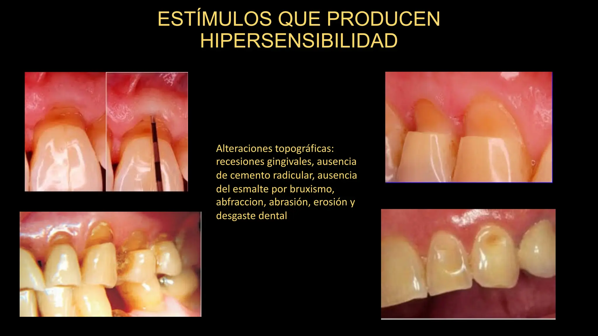 CLASE DX DIFERENCIAL ENTRE DOLOR DENTINARIO Y DOLOR PULPAR (1).pdf