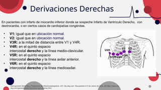 Interpretacion básica del electrocardiograma | PPTX