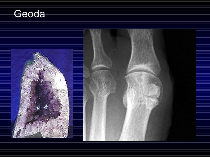 Clase Hueso Dr Figueroa Radiologia