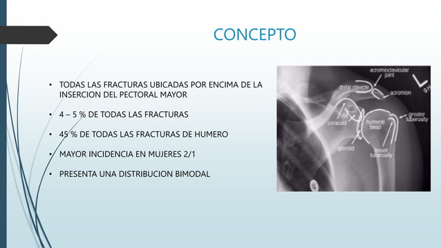 HUMERO PROXIMAL Y DIAFISARIA HUMERO.pptx