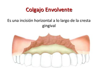 Cirugía Bucal | PPT
