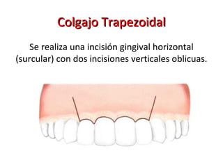 Cirugía Bucal | PPT