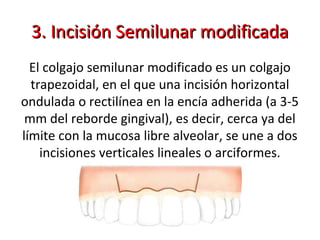 Cirugía Bucal | PPT