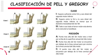 Clase II- MANEJO QUIRURGICO DE TERCERAS MOLARES.pptx