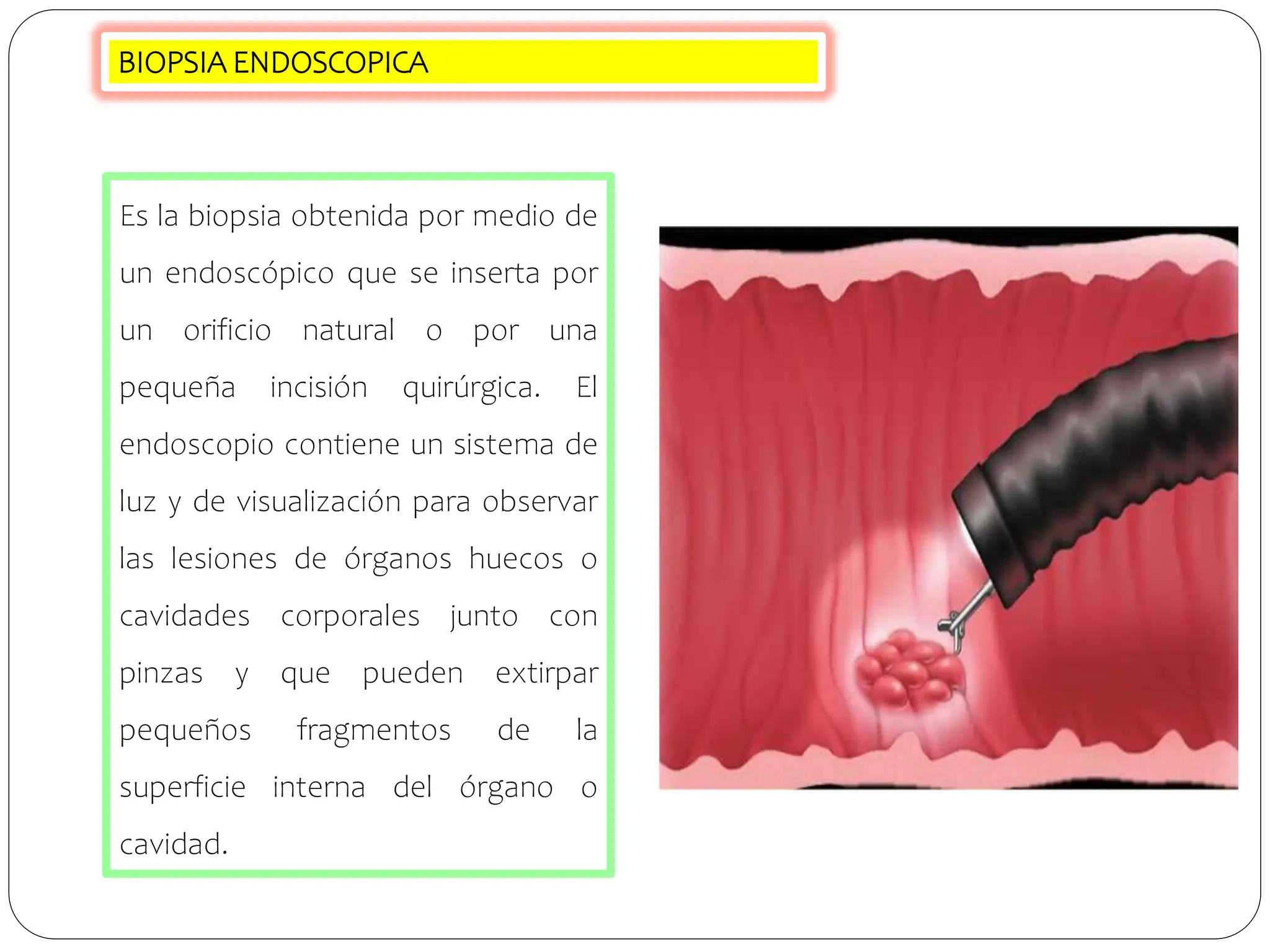 CLASE III BIOPSIA.pptx ENFERMERIA BIOPSIA | PPTX