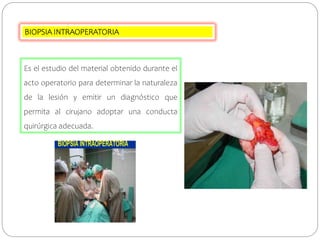 CLASE III BIOPSIA.pptx ENFERMERIA BIOPSIA | PPTX