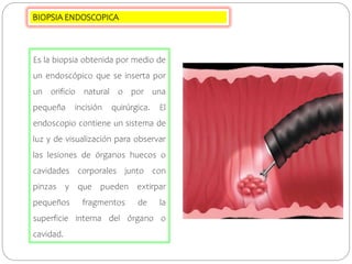 CLASE III BIOPSIA.pptx ENFERMERIA BIOPSIA | PPTX
