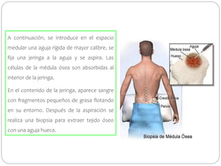 CLASE III BIOPSIA.pptx ENFERMERIA BIOPSIA | PPTX