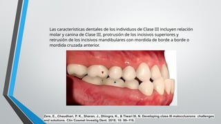 Manejo de maloclusion clase III con tecnica de roth.pptx